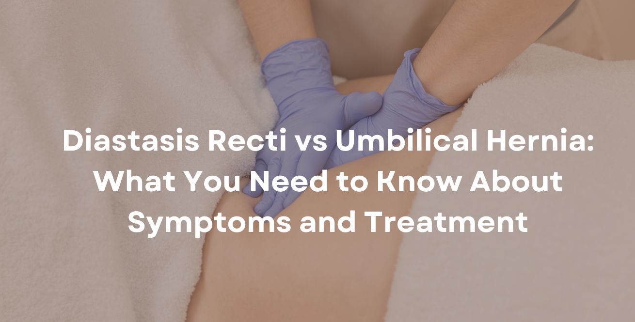 Diastasis Recti Vs Umbilical Hernia Differ And Treat 6463